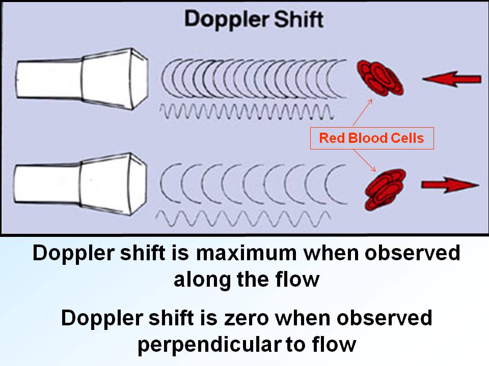 ektalks: Medical Imaging - Ultrasound Imaging; On the nature of sound waves