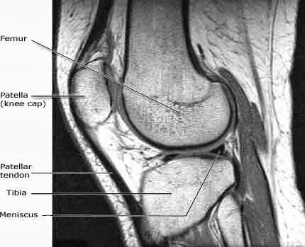 Radiología Musculo-Esqueletica: RMN de cuerpo (tórax, abdomen, pelvis)