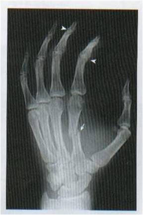 Radiology Squad: Teknik Pemeriksaan Radiografi Ossa Manus