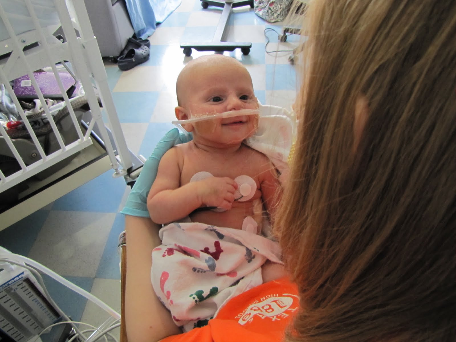 Congenital Lobar Emphysema: Andrew - Lobectomy at nearly 6 weeks old in ...