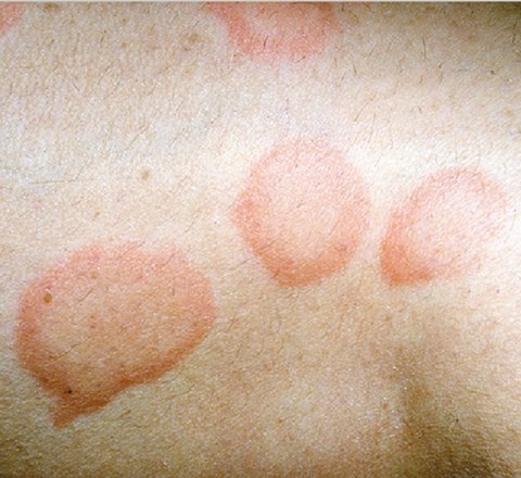 مجموعة مسائل متنوعة سريرية (1)