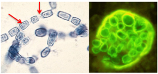 The Mycelium Connection: January 2013