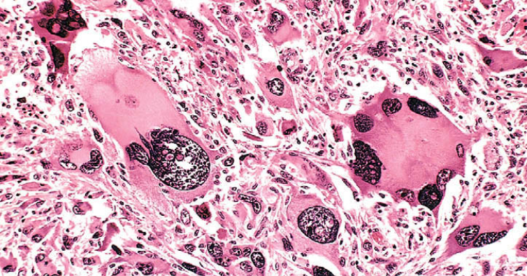 Atlas virtual de histologia e patologia: O QUE SÃO NEOPLASIAS?