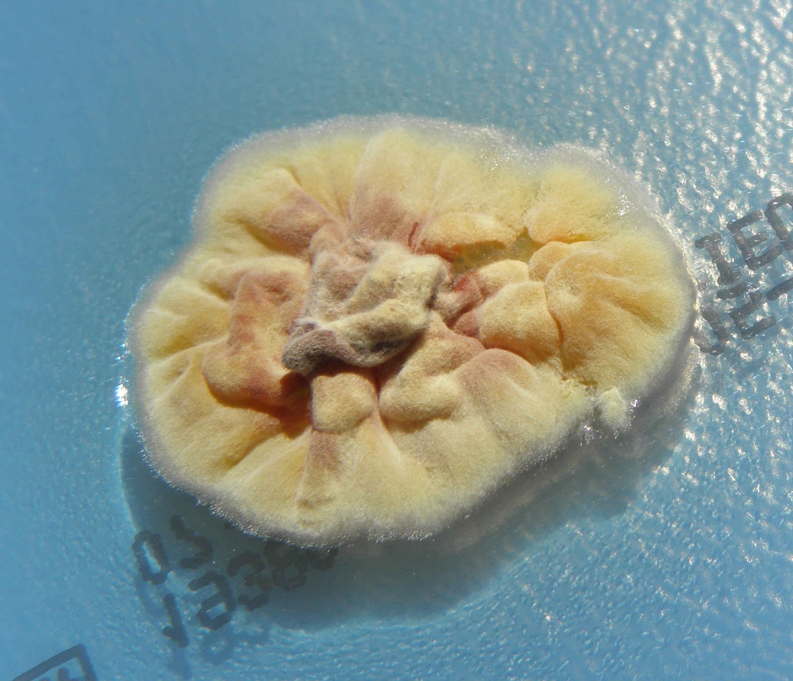 ATLAS MICOLOGIA: TRICHOPHYTON SOUDANENSE