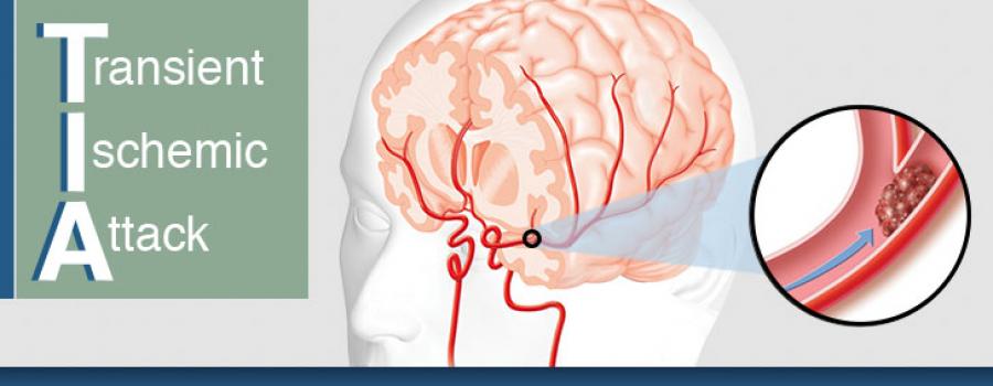 Prepare for Medical Exams : Transient Ischemic Attack