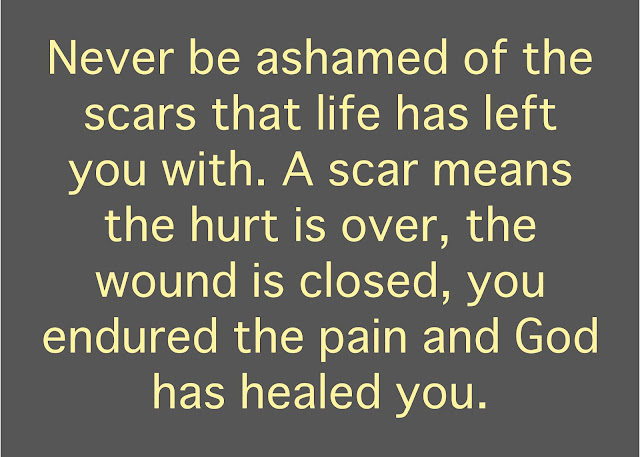 and Spiritually Speaking: Life's Scars