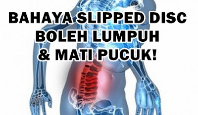 BAHAYA SLIPPED DISC BOLEH MENYEBABKAN LUMPUH DAN MATI PUCUK!