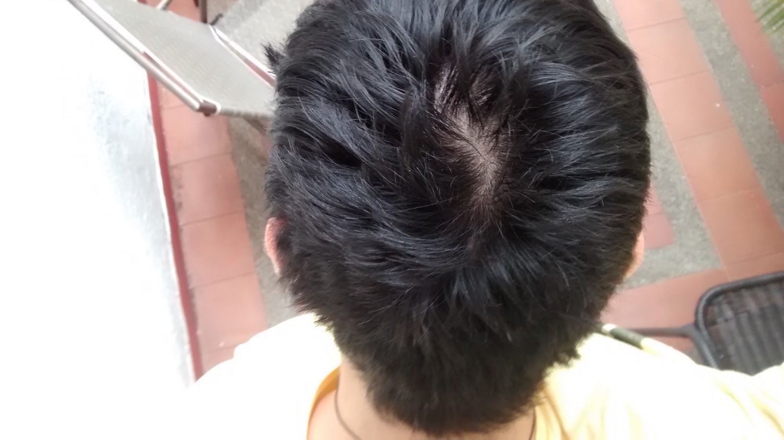 5 PARA TODO: 5 posibles falsas señales de calvicie