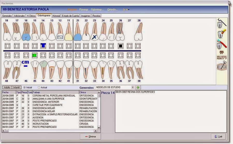 Cuidado de la salud bucal: ¿Qué es un odontograma?