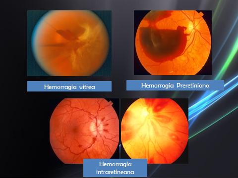 POSTGRADO DE NEUROCIRUGÍA - HOSPITAL CENTRAL DE MARACAY - VENEZUELA ...