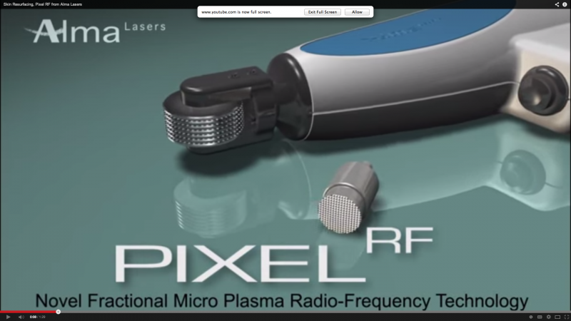 Laser Treatments: Pixel RF