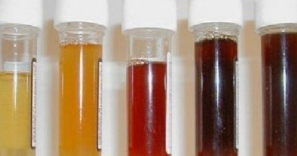 What The Color Of Your Urine Reveals About Your Health | Savvy Life Mag ...