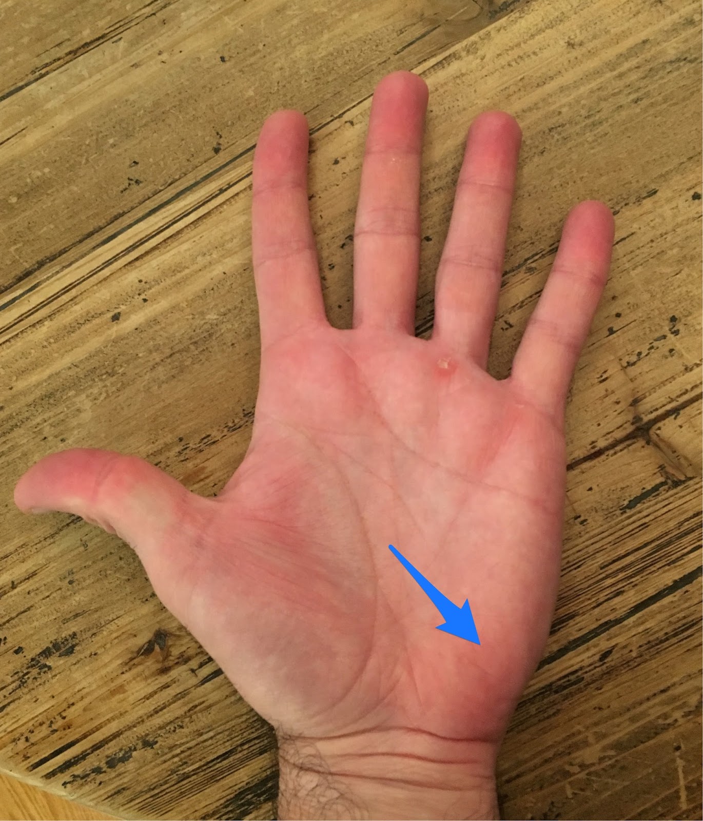 Young Athlete Center Wrist Pain In Baseball young-athlete-center-wrist-pain-in-baseball