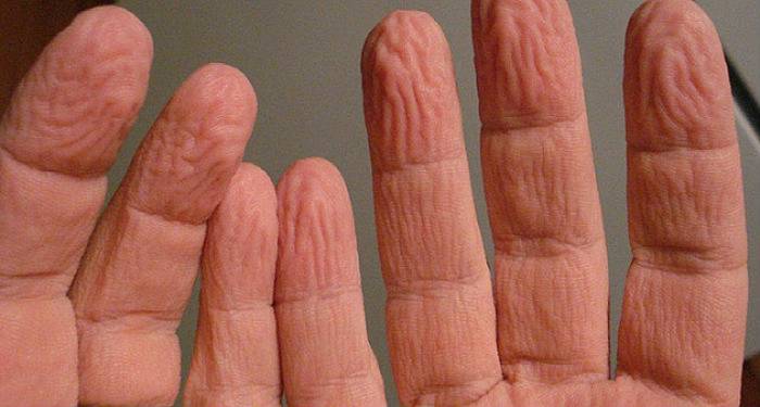 Your Pinky Finger Reveals A Lot About You | CrazePortal