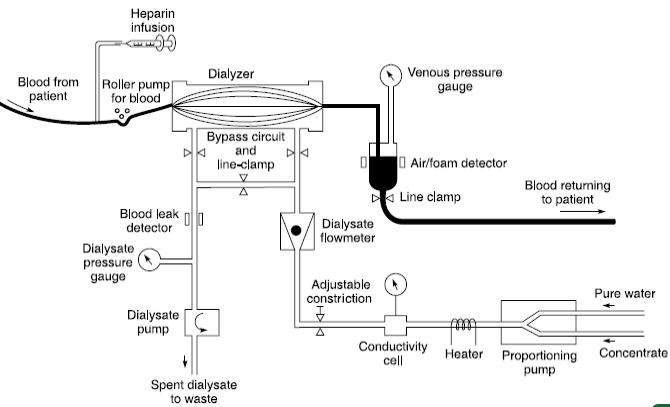 Dialysis Meaning