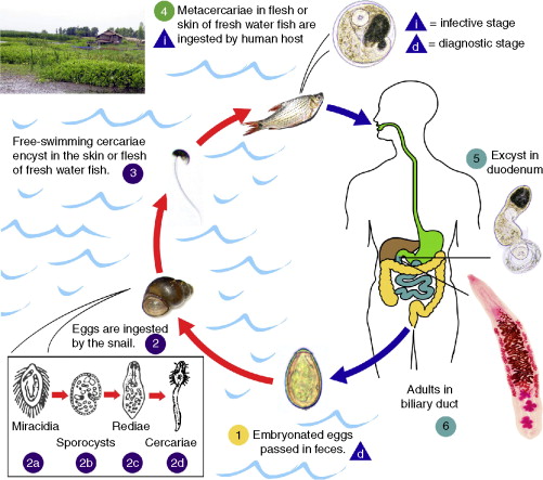 Lakukan Detoks Parasit Jika Terdapat Tanda-tanda Ada Cacing Dalam Badan ...