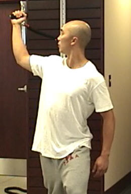 Cannondale Club: Clavicle Fracture - Indicative Rehab Exercise Program