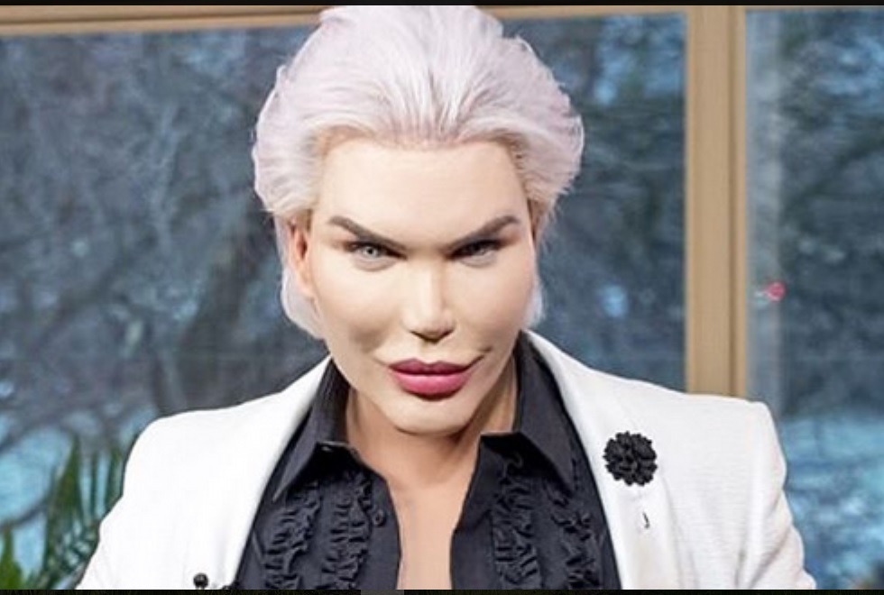 Así luce Rodrigo Alves, 'El Ken humano', tras quitarse cuatro costillas