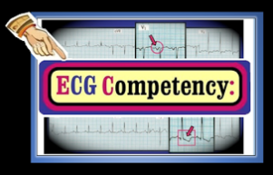 ECG Interpretation: ECG Interpretation Review #47 (Normal Variants ...