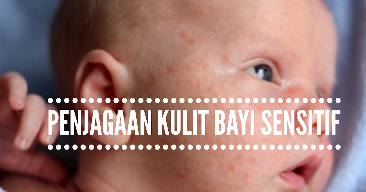 SET MANDIAN BABY KULIT SENSITIF