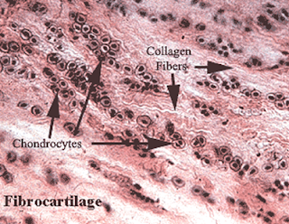 nr: (b) Rawan Fibrosa