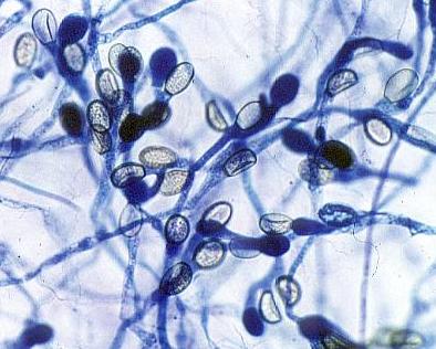 Info Biologi: BASIDIOMYCOTA