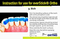 DENTAL MATERIALS: Fibre-reinforced composite bridge with everStick C&B ...