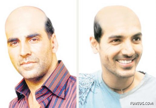 Gambar Lawak : Bagaimana jika artis botak?