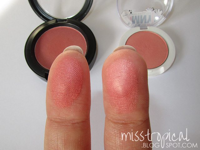 Pain In Eye After Cataract Surgery