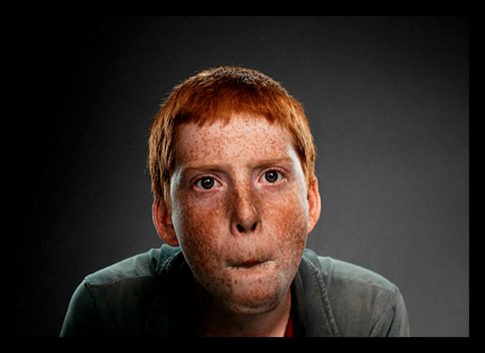 Immersion. Robbie Cooper | Doctor Ojiplático