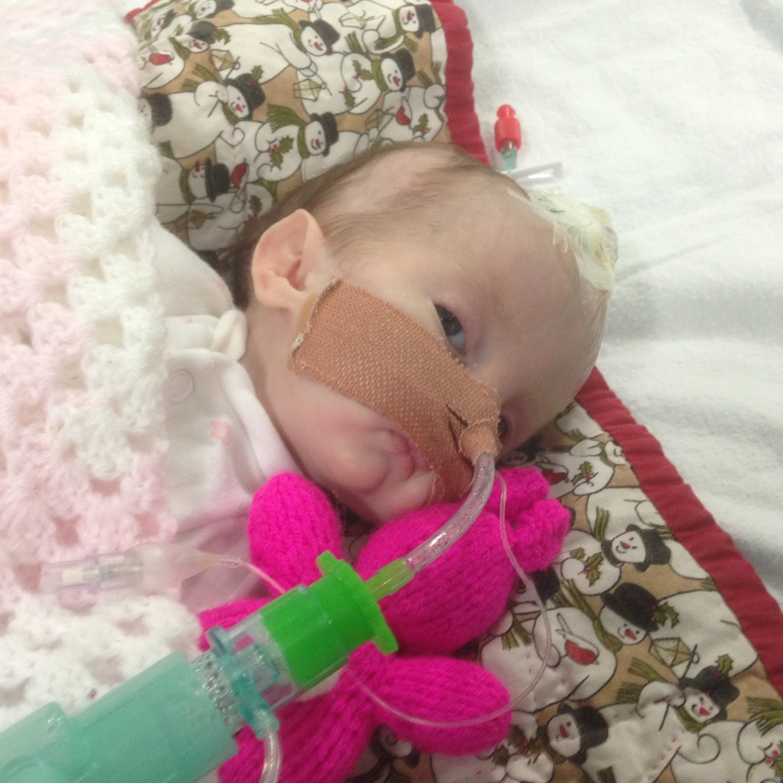 NICU Basics: Respiratory support | Rumer's Rainbow