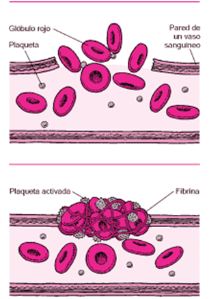 Enfermería en Hematología y Hematoterapia: FIBRINOLISIS