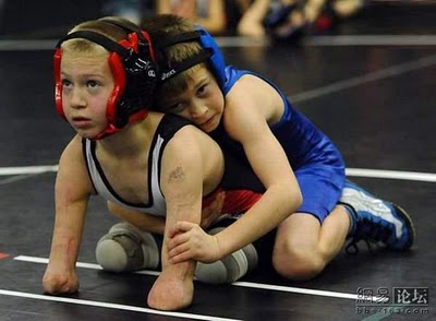 Jenis-jenis Cacat | SMPLB YPLB BANJARMASIN