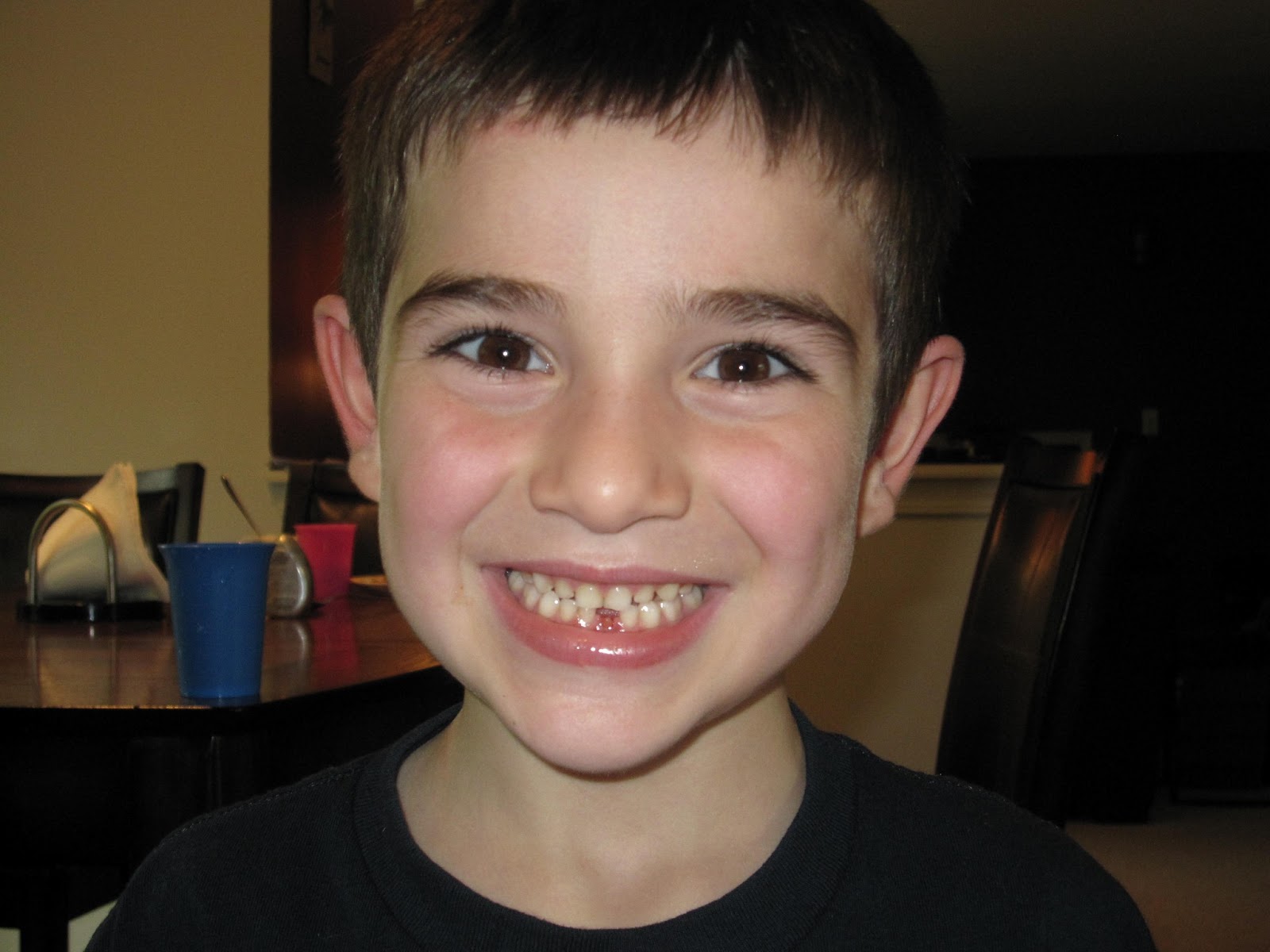 The Highland Schneiders: Jack's first lost tooth