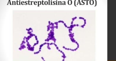 Técnicas inmunológicas.: Titulación de antiestreptolinas “o” (ASTO).