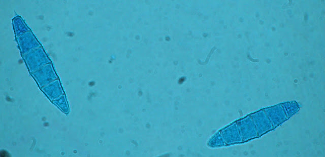 ATLAS MICOLOGIA: MICROSPORUM GYPSEUM