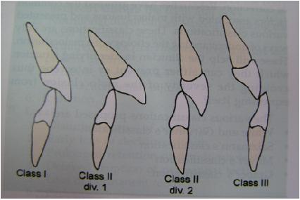 Dentistry lectures for MFDS/MJDF/NBDE/ORE: History taking and ...