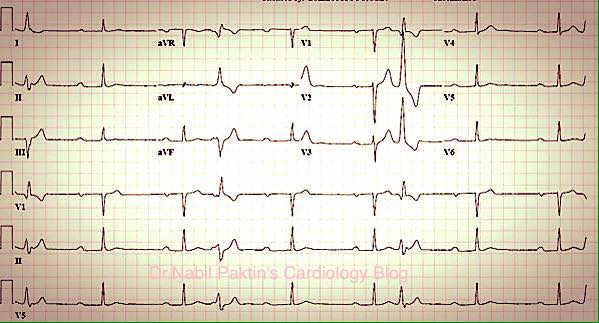 Dr.Nabil Paktin's Journal of Cardiovascular Medicine Blog ژورنال ( قلب ...