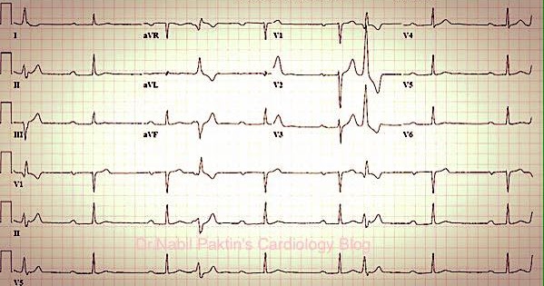 Dr.Nabil Paktin's Journal of Cardiovascular Medicine Blog ژورنال ( قلب ...