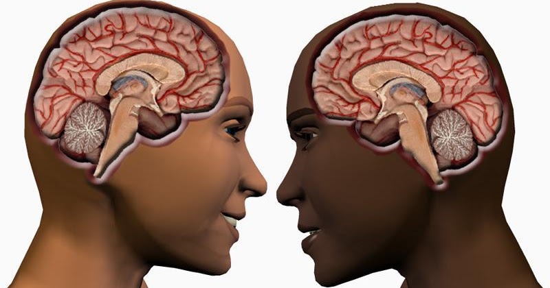 Autism Brain Comparison