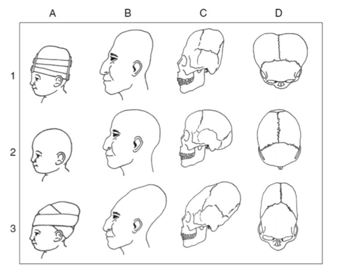 "Missy Skull" Unexplained Skull Study