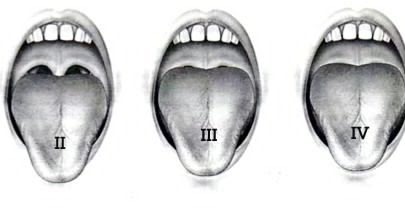 Praxis Médica: Escala de Mallampati (intubación)