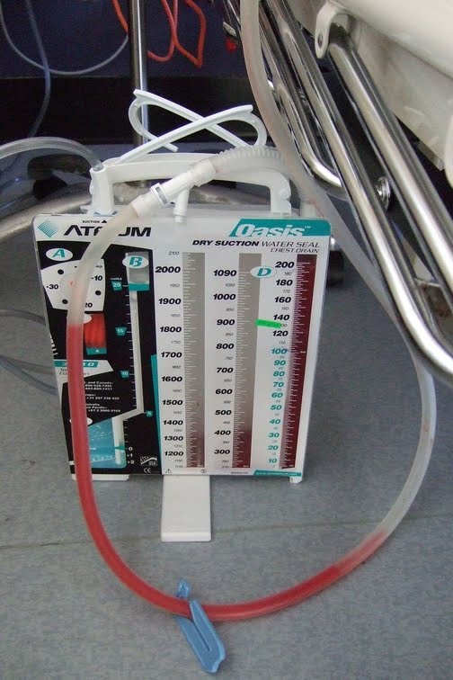 Cancer Is Not A Disease: My Survival Tips