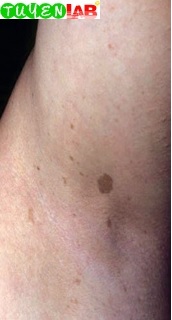 [Dermatology] Atlas of Cutaneous Signs and Diagnosis (Part 1) | Free ...