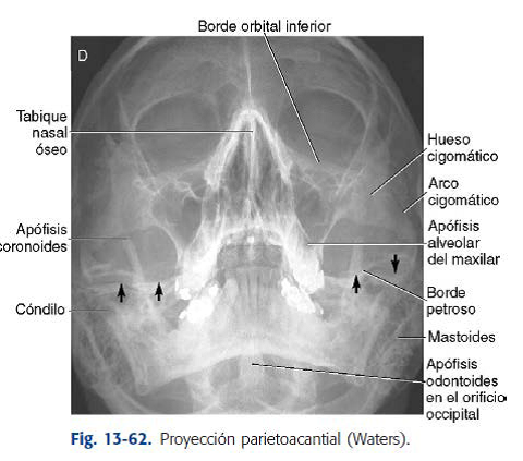 PRODUCCION Y TRATAMIENTO DE IMAGENES DIAGNOSTICAS: CAPITULO HUESOS ...