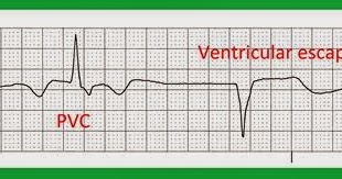 Float Nurse: Various Escape Beats