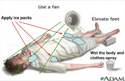 THIS IS MY BLOG !!: Kesihatan - Heat Stroke aka Strok Haba