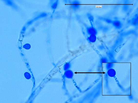 Fun With Microbiology (What's Buggin' You?): Sepedonium species