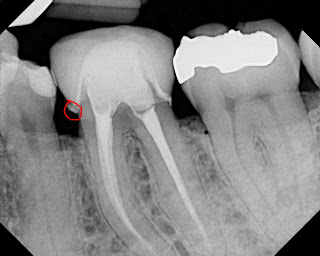 AJIDS e - Library.: A look into the clinical practice of endodontics.