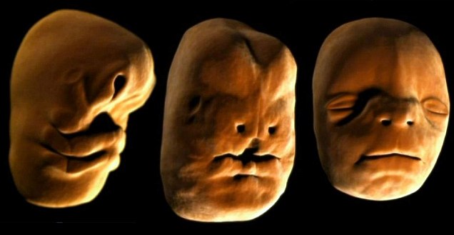 alamcyber 2020: Menakjubkan Video Pembentukan Wajah Janin Dalam Kandungan